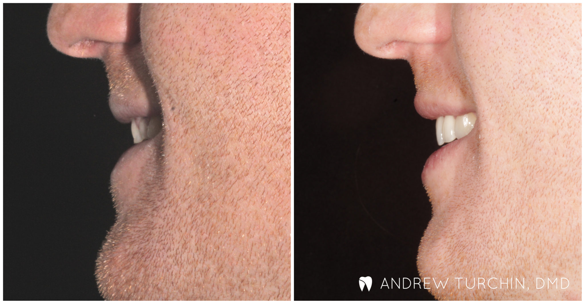 The Ageless Smile - Andrew Turchin DMD